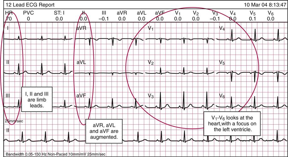 To 12 Lead Interpretation Thoracic Key