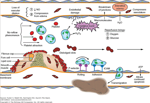 Molecular And Cellular Mechanisms Of Myocardial Ischemia Reperfusion