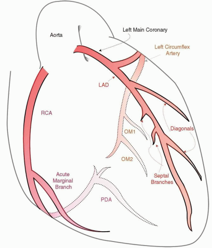 Ischemic Patterns Thoracic Key