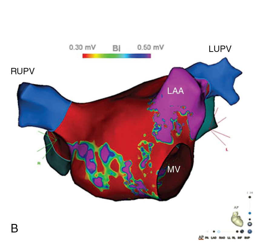Electroanatomic Mapping Electroanatomic Mapping System Hysk